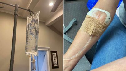 How to Choose the Right IV Drip Treatment for Your Needs