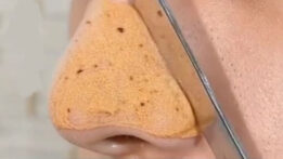 7 Tactical Tricks to Help You Get Rid of Blackheads